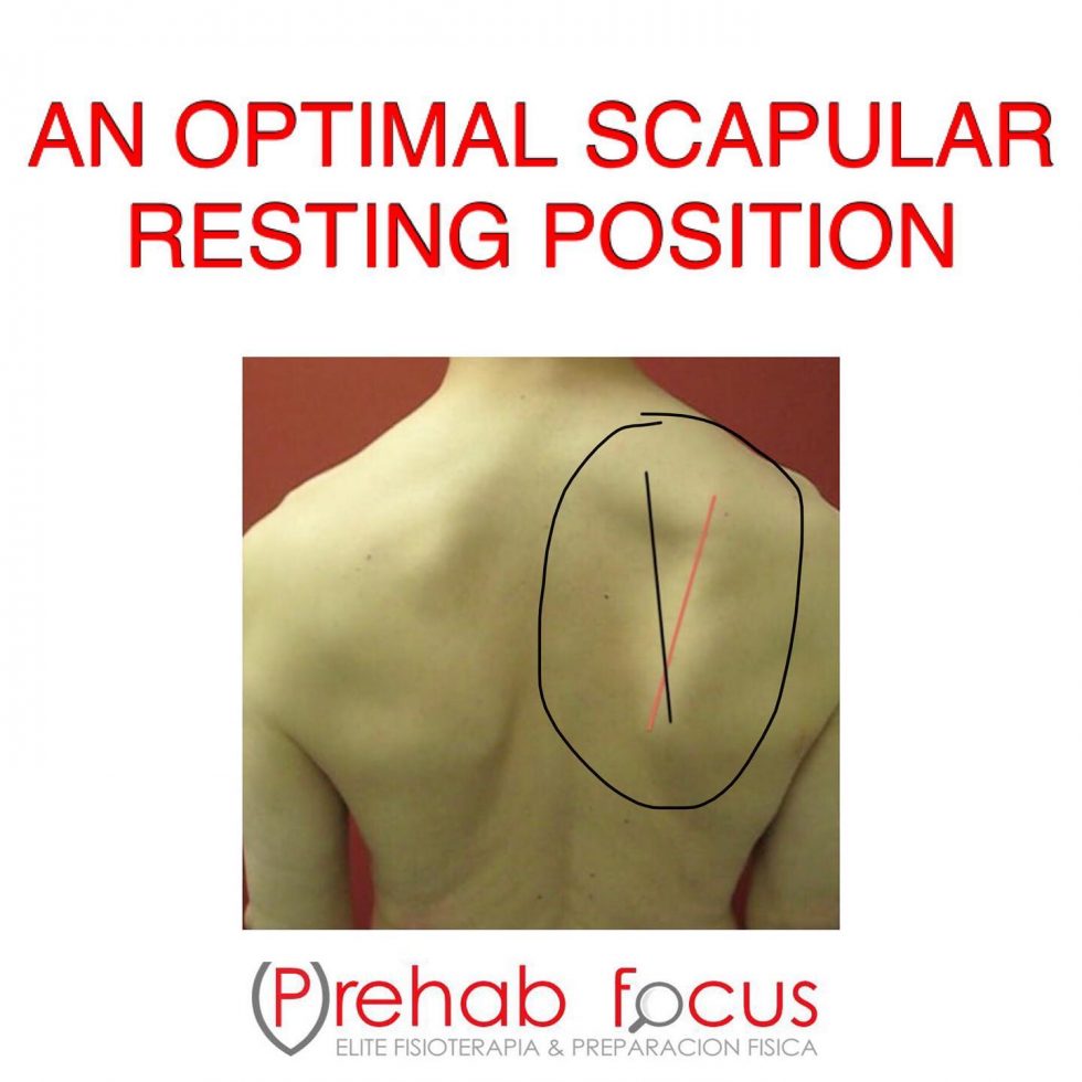 An optimal scapular resting position - Prehab Focus